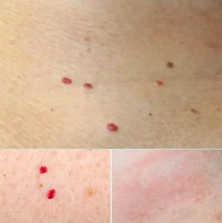 Red Spots on Skin: 13 Common Causes – Best Recipes
