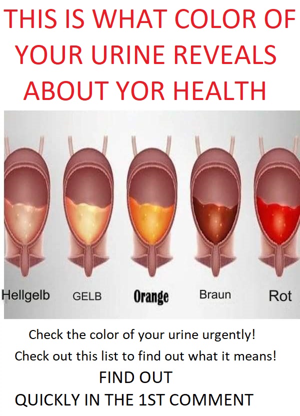What You Should Know: The Color of Your Urine Determines Your Kidney ...